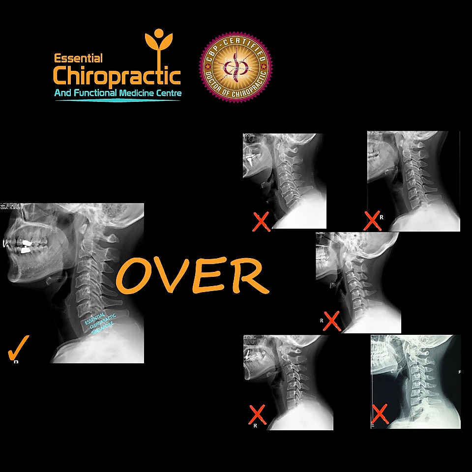 A better curve in your neck - better function, better health.